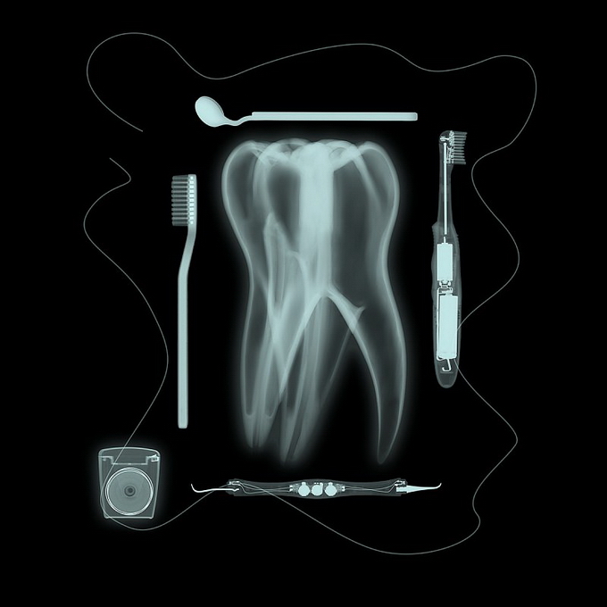 Objects Seen Through X-Rays - Internet Vibes