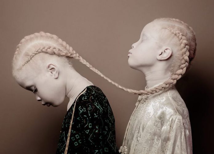 Charming Twins-Albinos Blow Up the Internet with their Unique Beauty.